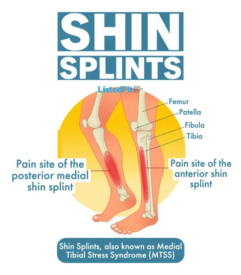 Shin Splint Cures - Tips and Exercises for a Speedy Recovery - ListedFit